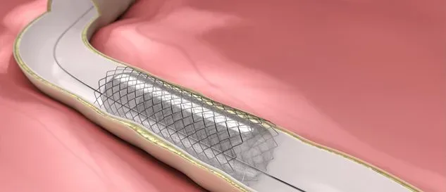 Interventional cardiac procedures | NAH